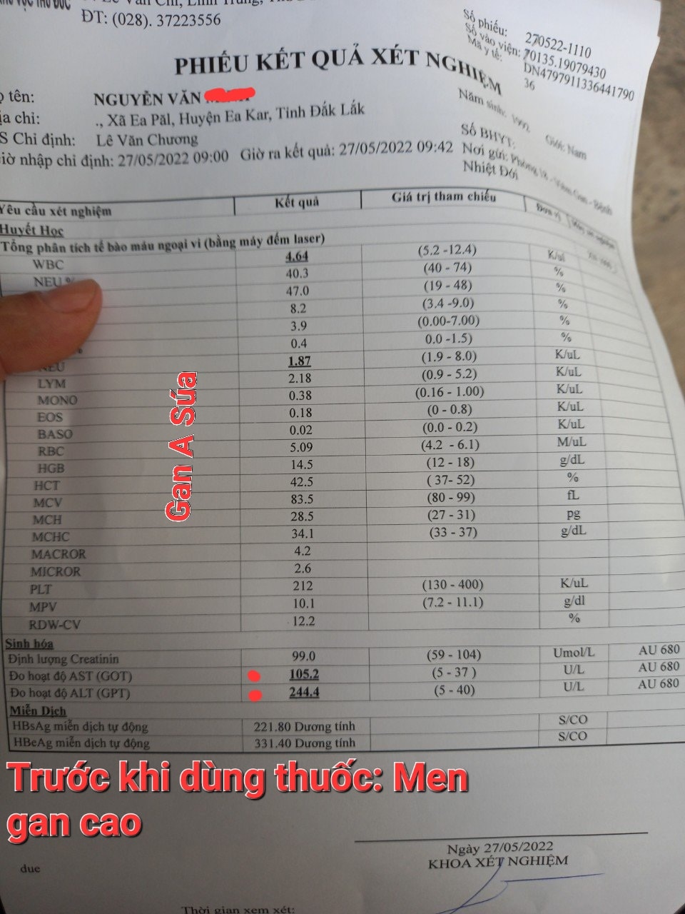 MEN GAN CAO LÀ GÌ? ĐIỀU TRỊ MEN GAN CAO - GAN A SÚA